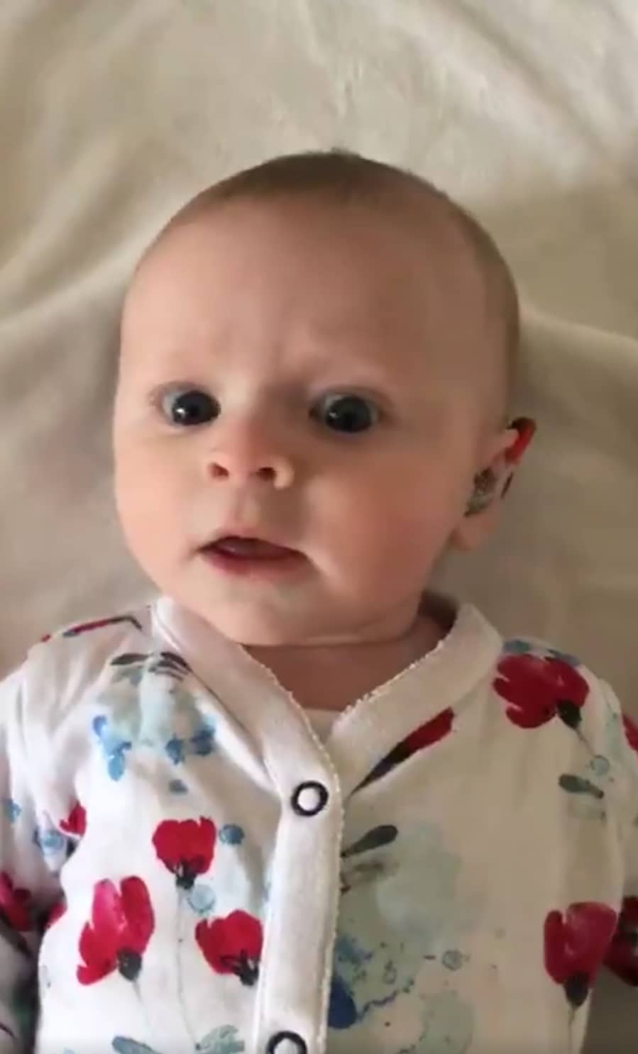 Baby Hears Mom's Voice For The First Time With Her New Hearing Aids