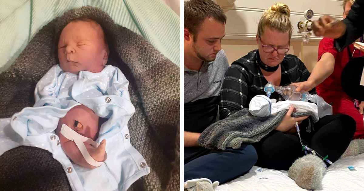 Baby Born With Mermaid Tail Dies In Daddy's Arms After Taking Baptism ...